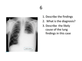 Diagnostic radiology assignment.pptx