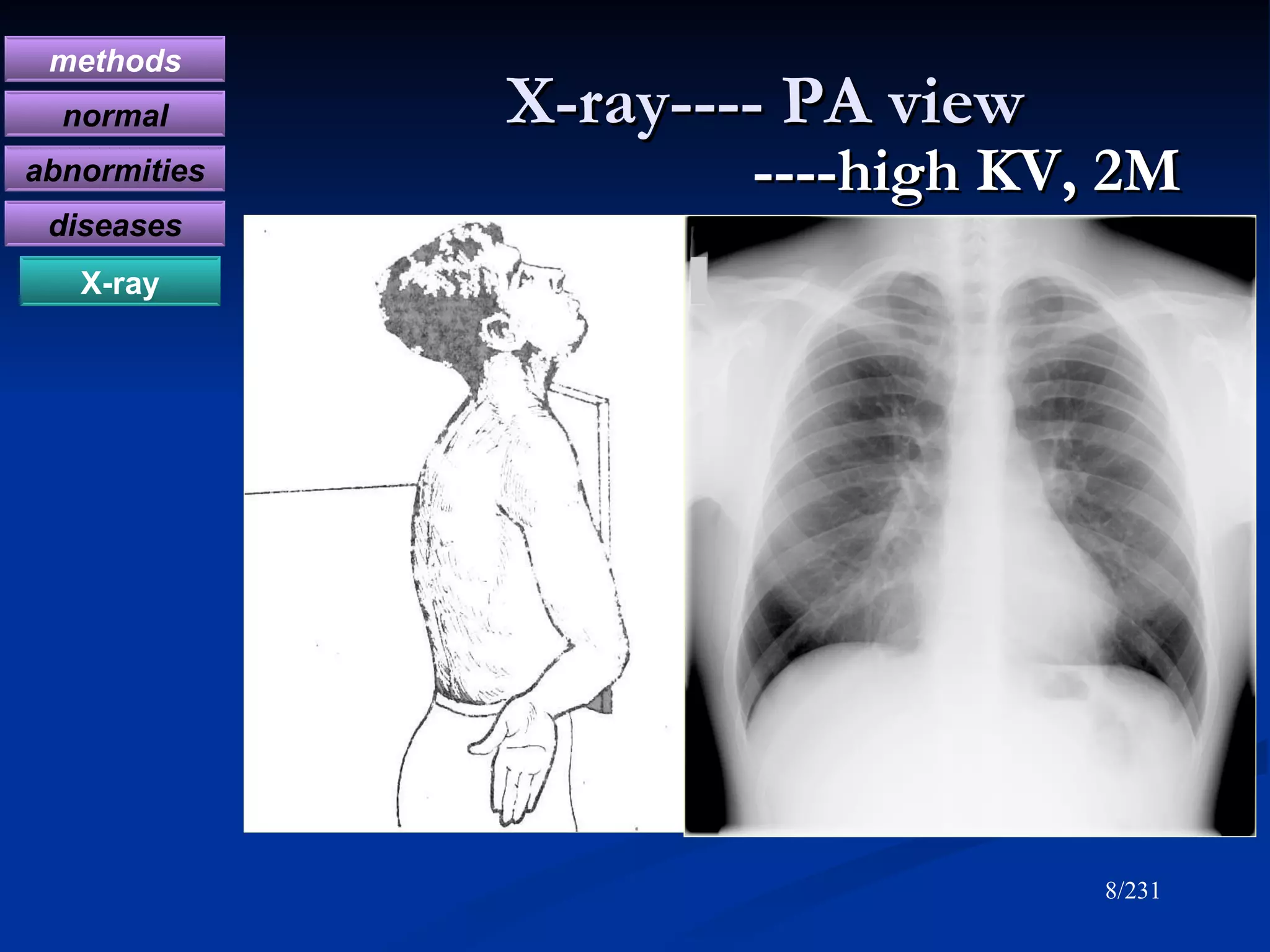 Diagnostic radiology of cardiovascular 2009 | PPT