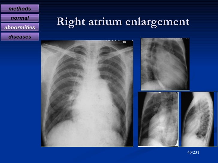 Diagnostic radiology of cardiovascular 2009