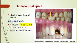 Diagnostics of Dental implant .scientific day 2025.pdf