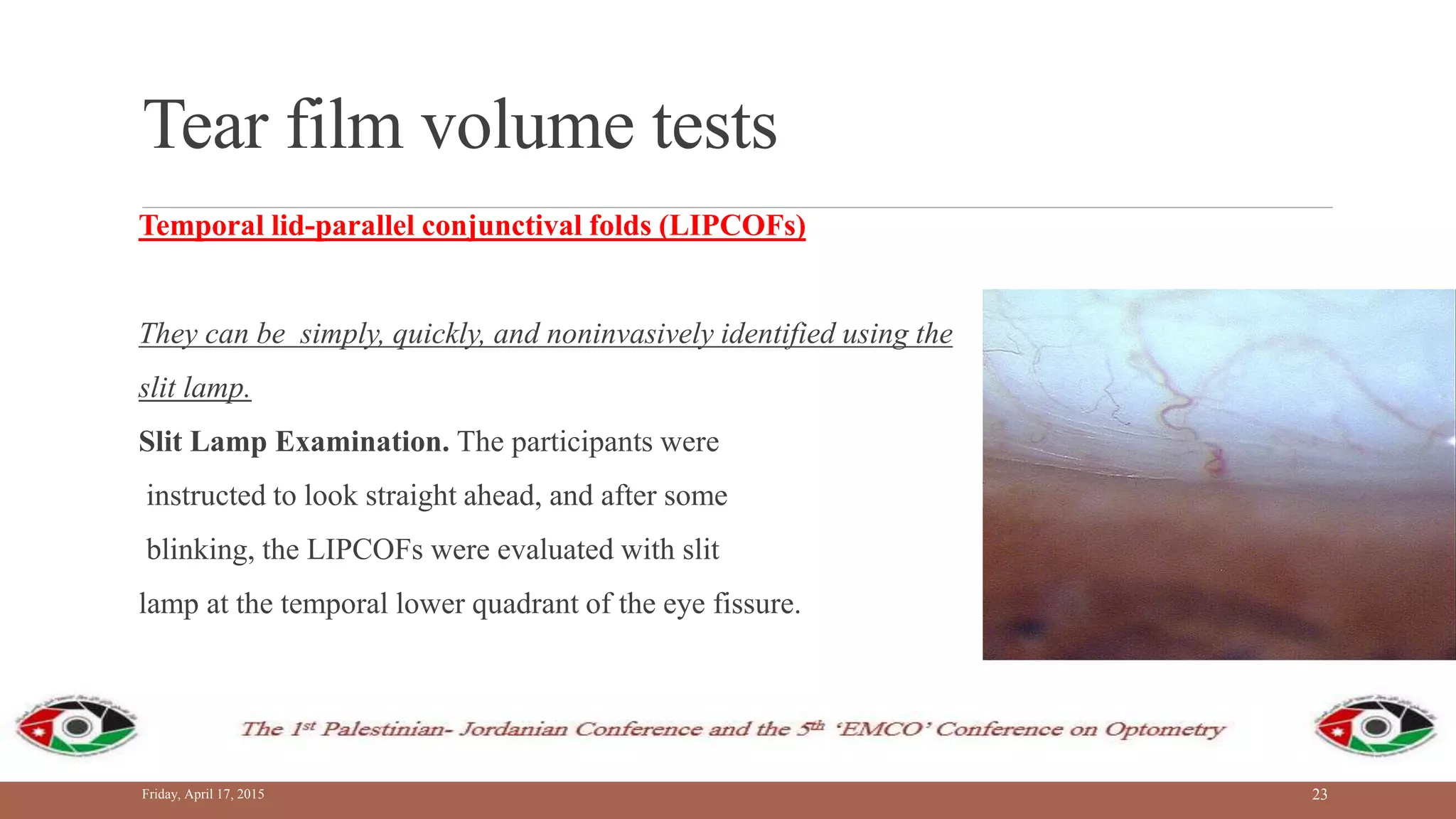 Diagnostic techniques of dry eye | PPTX | Eye and Vision Conditions ...