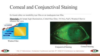 Diagnostic techniques of dry eye | PPTX