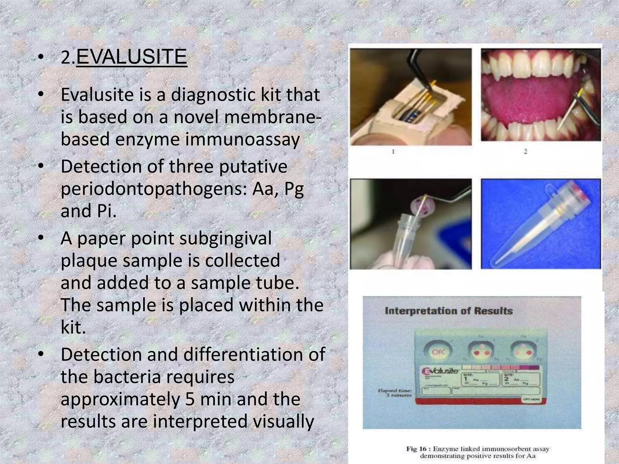 Diagnostic test and investigation in periodontology | PPTX
