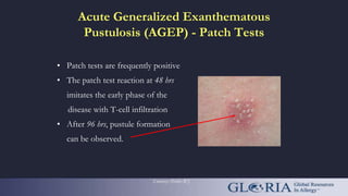 Diagnostic test for drug allergy | PPTX | Allergies | Diseases and ...