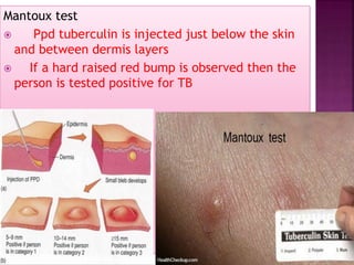 Diagnostic tests | PPTX
