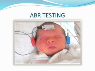 Diagnostic tests | PPTX