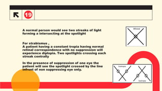 BSV & Orthoptics Diagnostic tests by jasmin modi | PPT