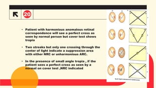 BSV & Orthoptics Diagnostic tests by jasmin modi | PPT