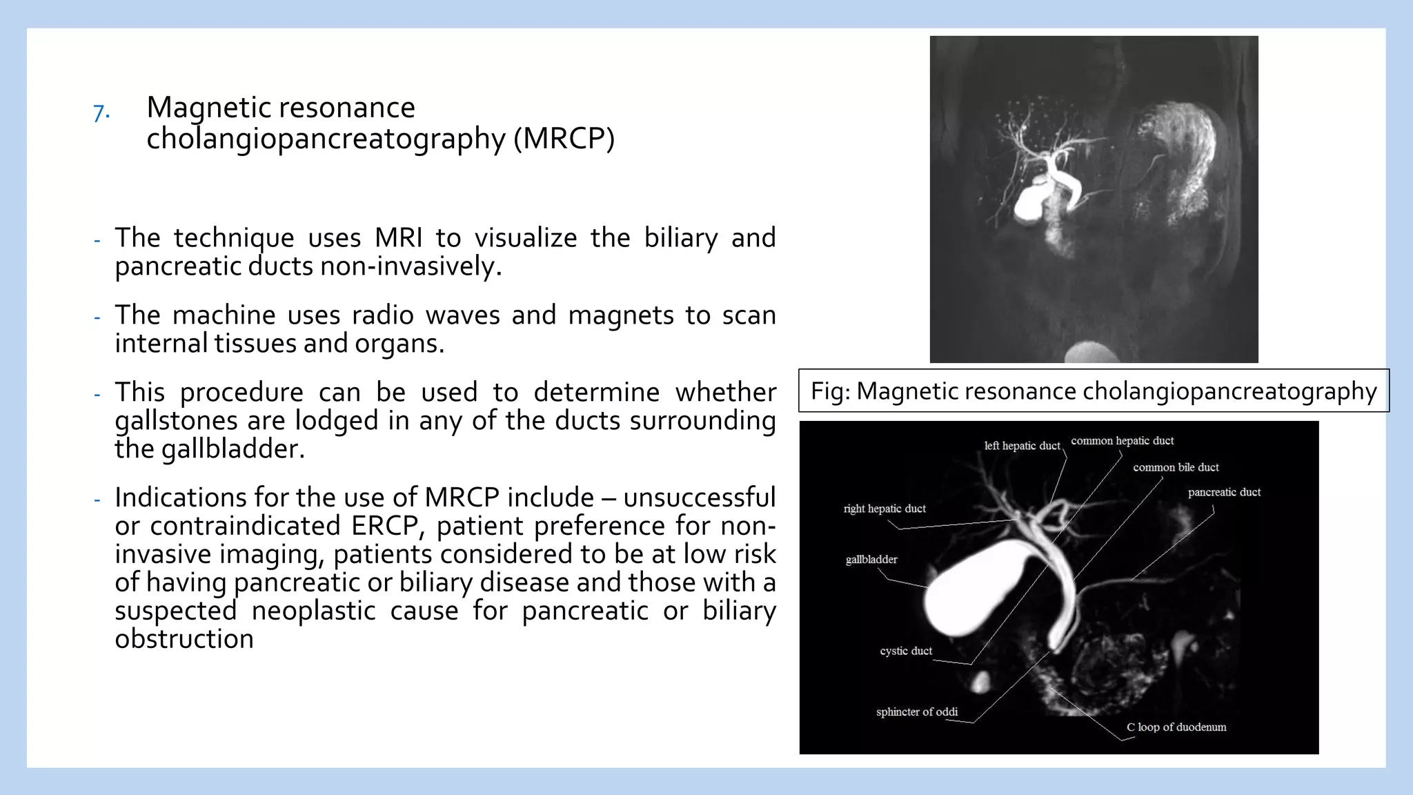 Diagnostic tests for GI disorders | PDF