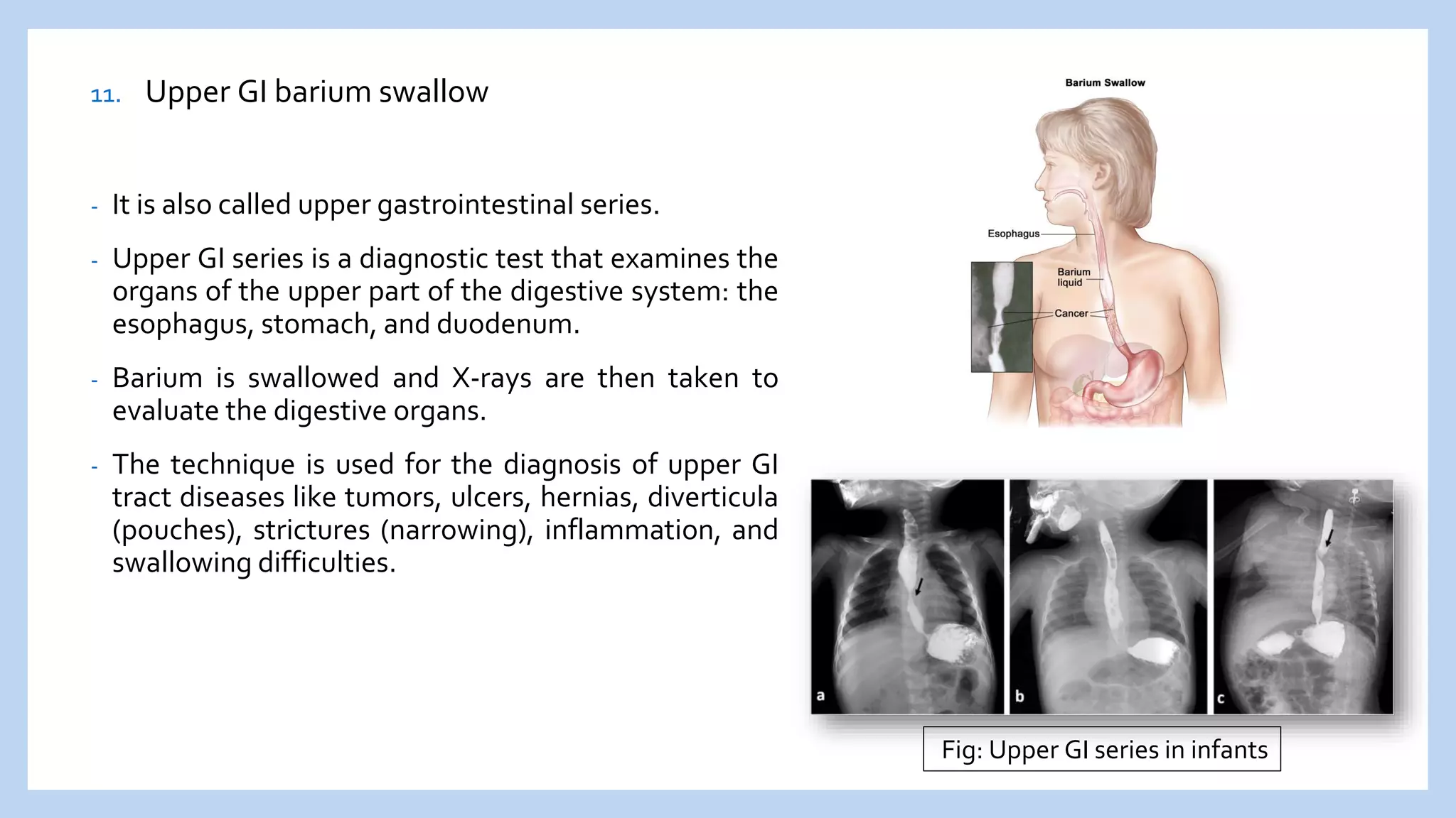 Diagnostic tests for GI disorders | PDF