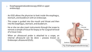 Diagnostic tests for GI disorders | PDF