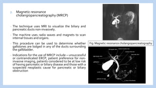 Diagnostic tests for GI disorders | PDF