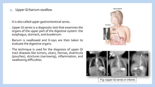 Diagnostic tests for GI disorders | PDF