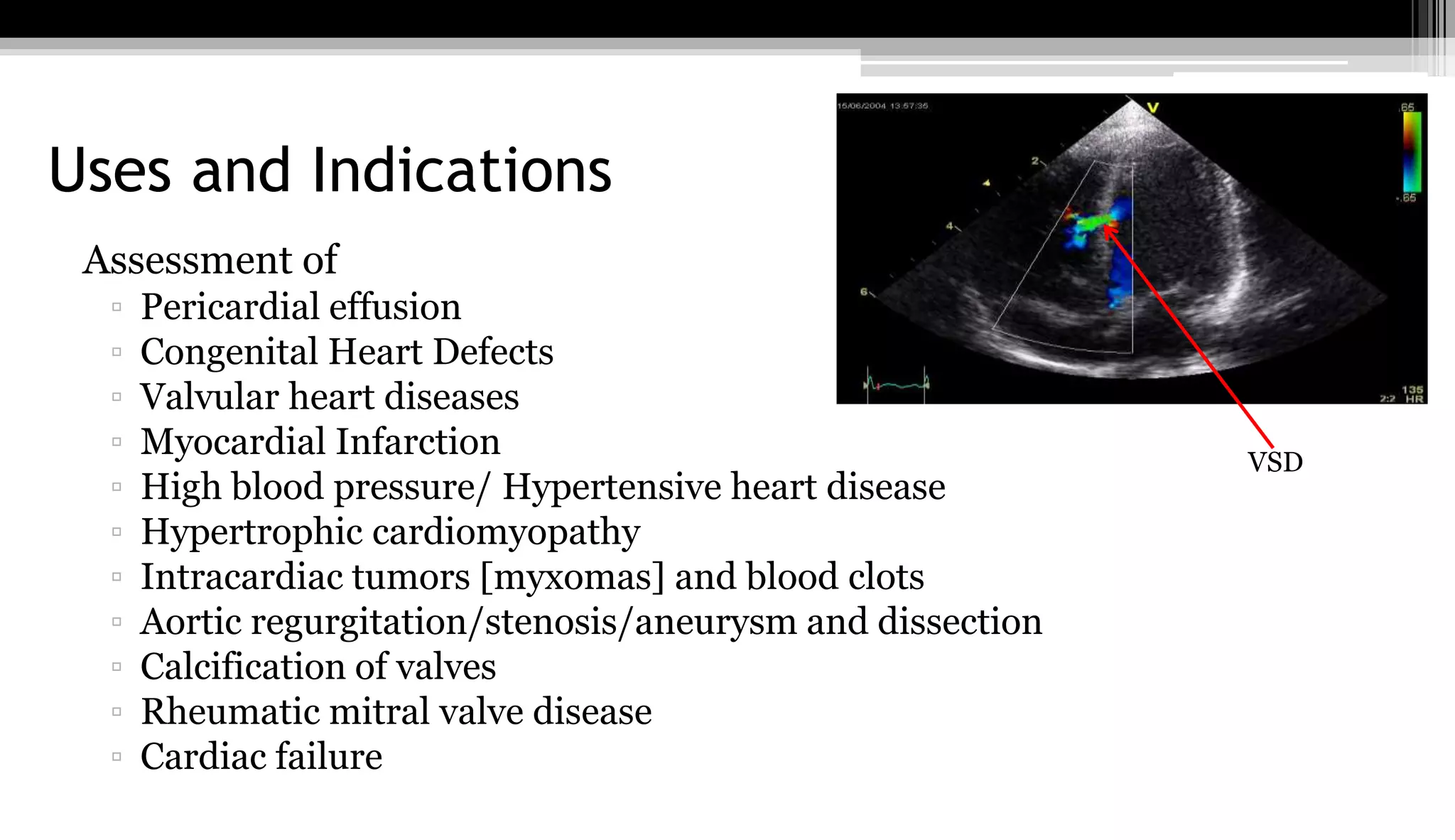 Diagnostic tests in cardiology | PPTX