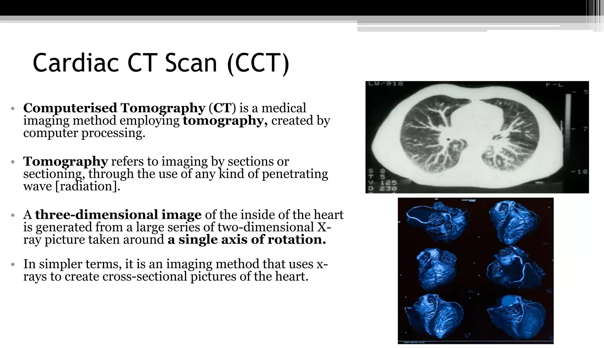 Diagnostic tests in cardiology | PPTX