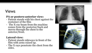 Diagnostic tests in cardiology | PPTX