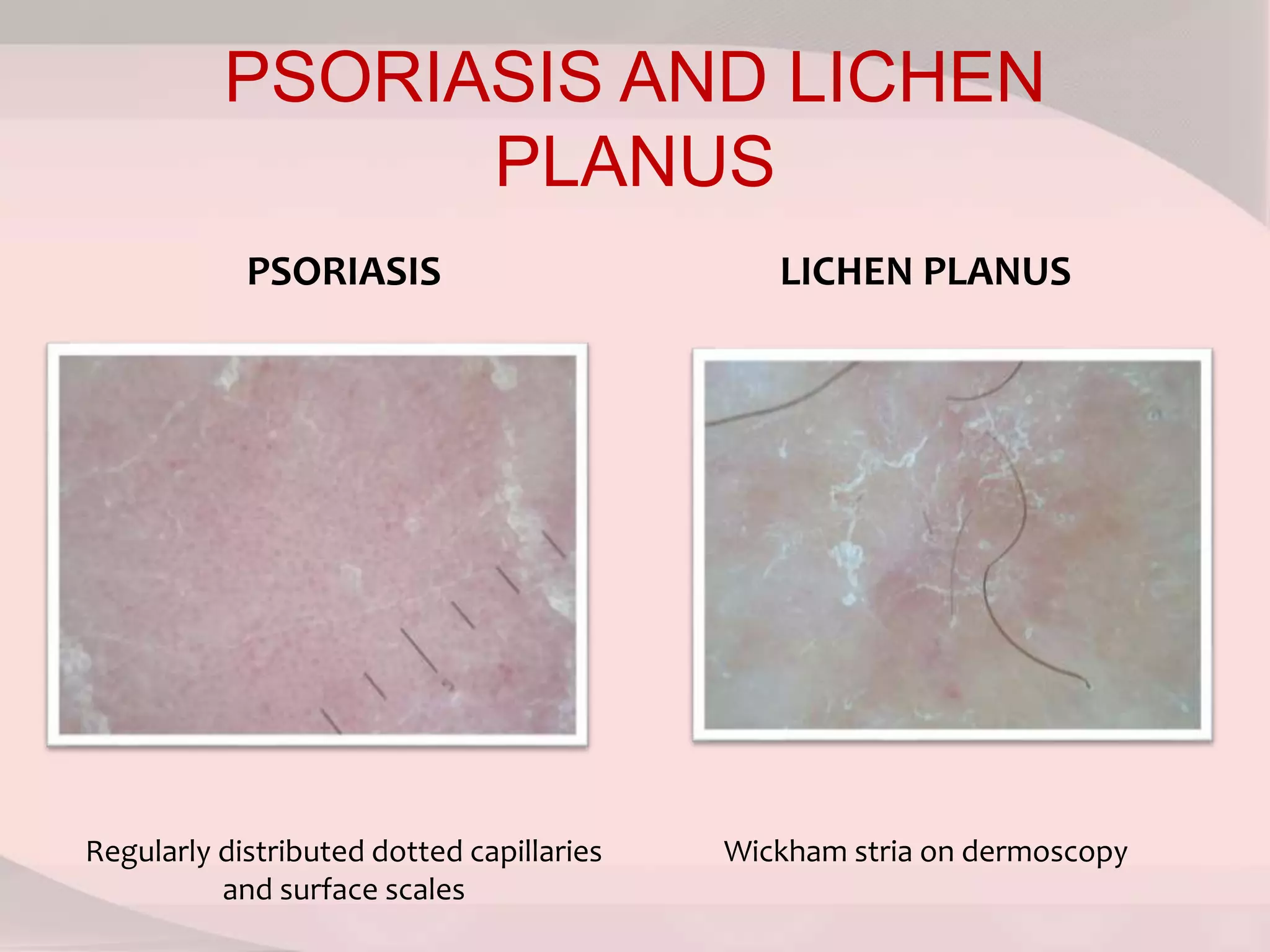 Diagnostic tests in dermatology | PPTX