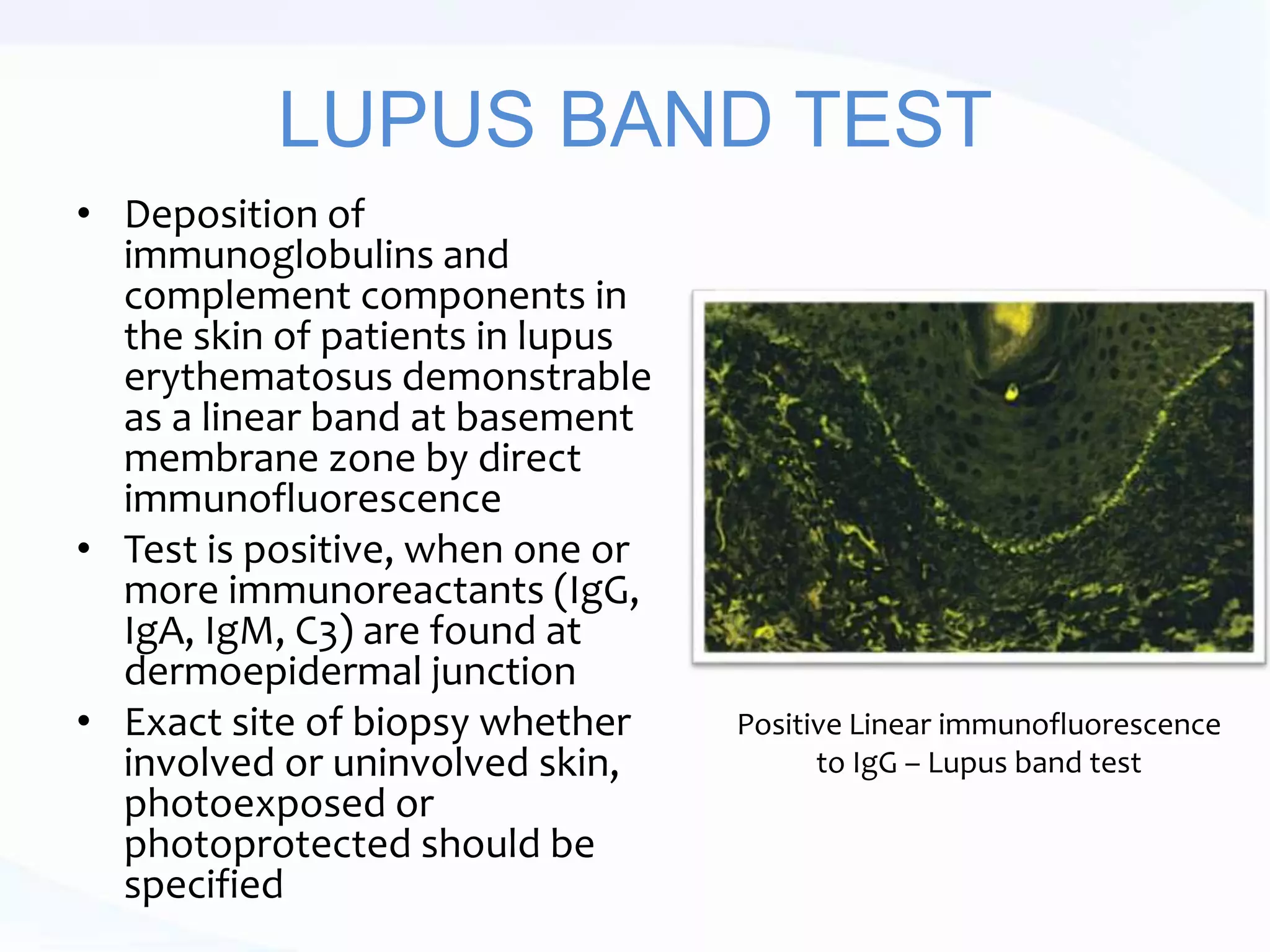 Diagnostic tests in dermatology | PPTX
