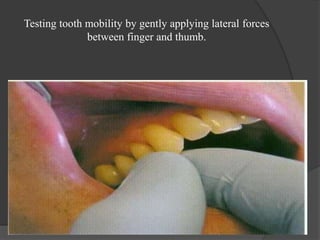 Diagnostic tests in operative dentistry | PPTX