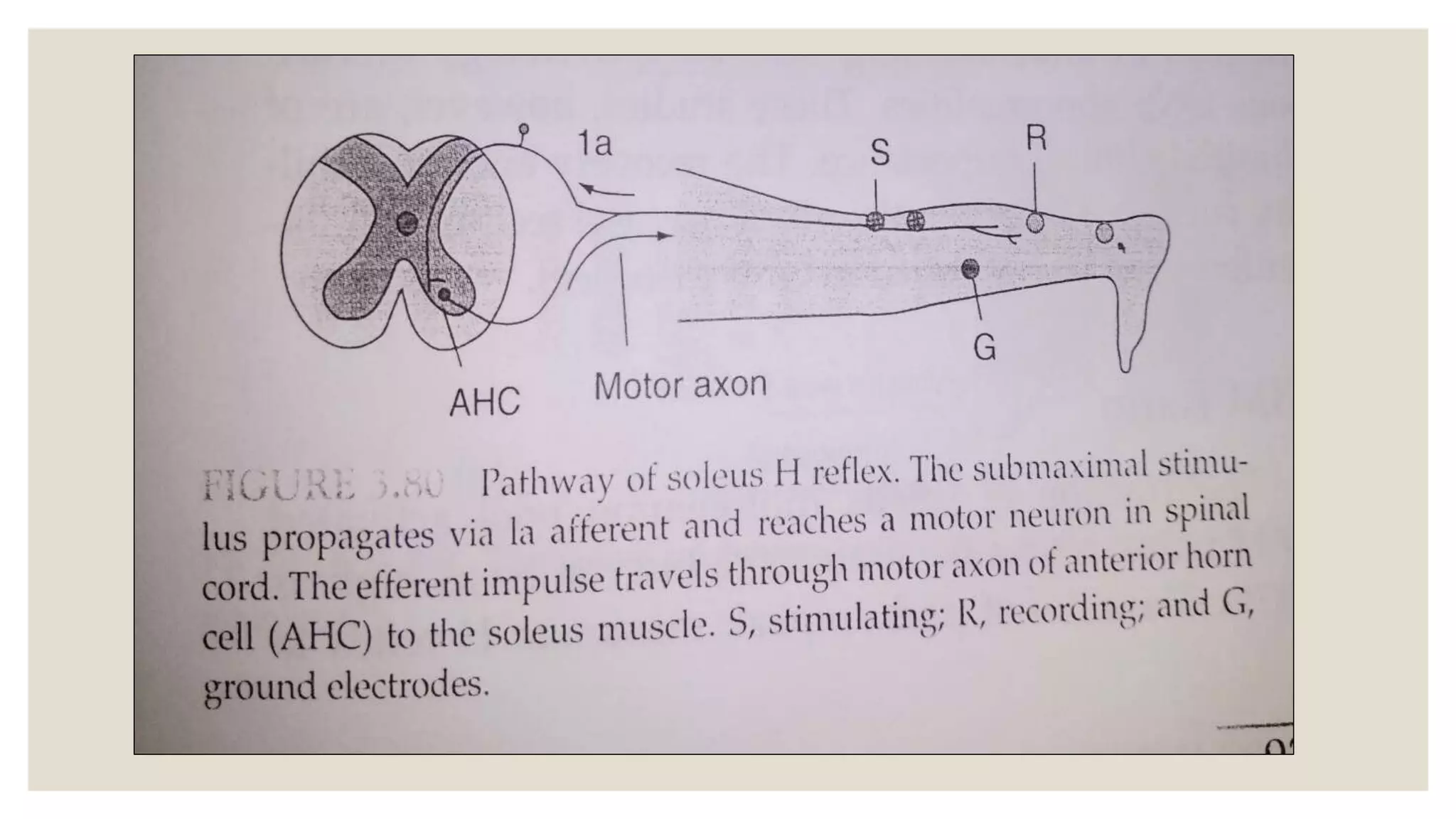 Diagnostic tests in Physiotherapy.pptx
