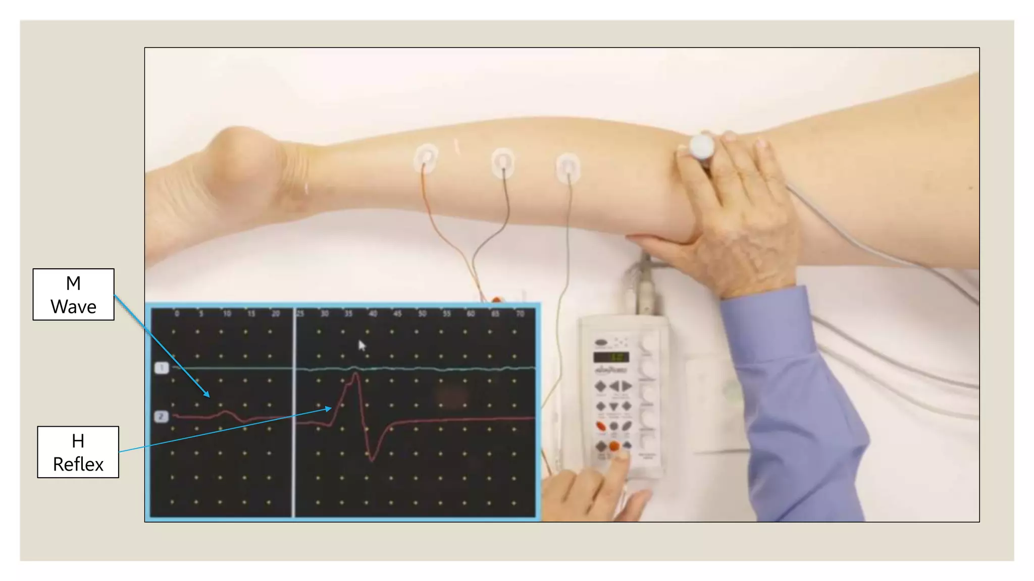 Diagnostic tests in Physiotherapy.pptx