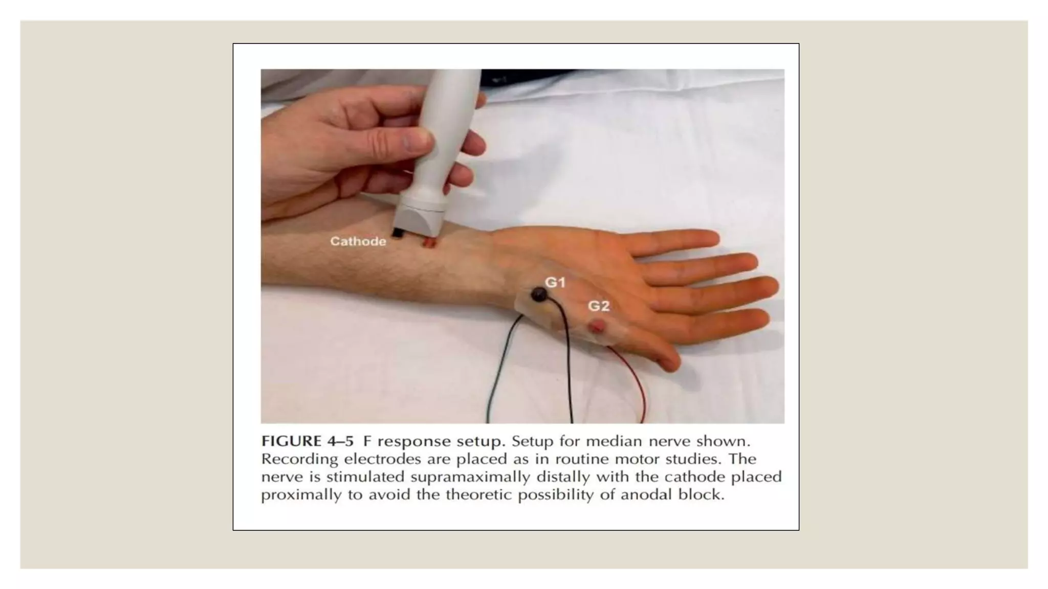 Diagnostic tests in Physiotherapy.pptx