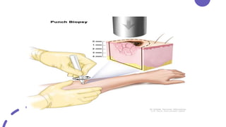 Diagnostic test skin | PPT