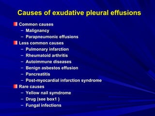 Symptoms And Signs Of Pleural Effusion: Treatment – NVAON