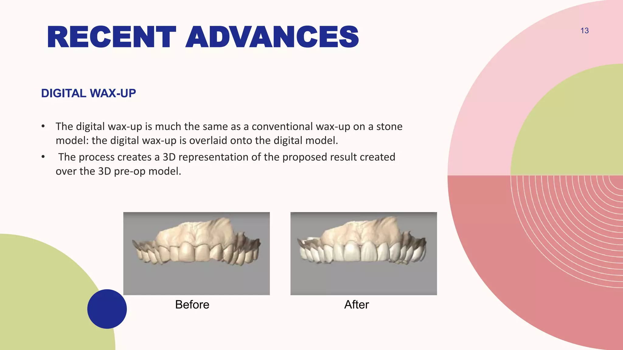 Diagnostic Wax-Up & Importance.pptx