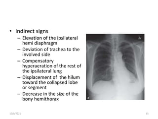 Diagnostic work of thoracic surgery patients | PPTX
