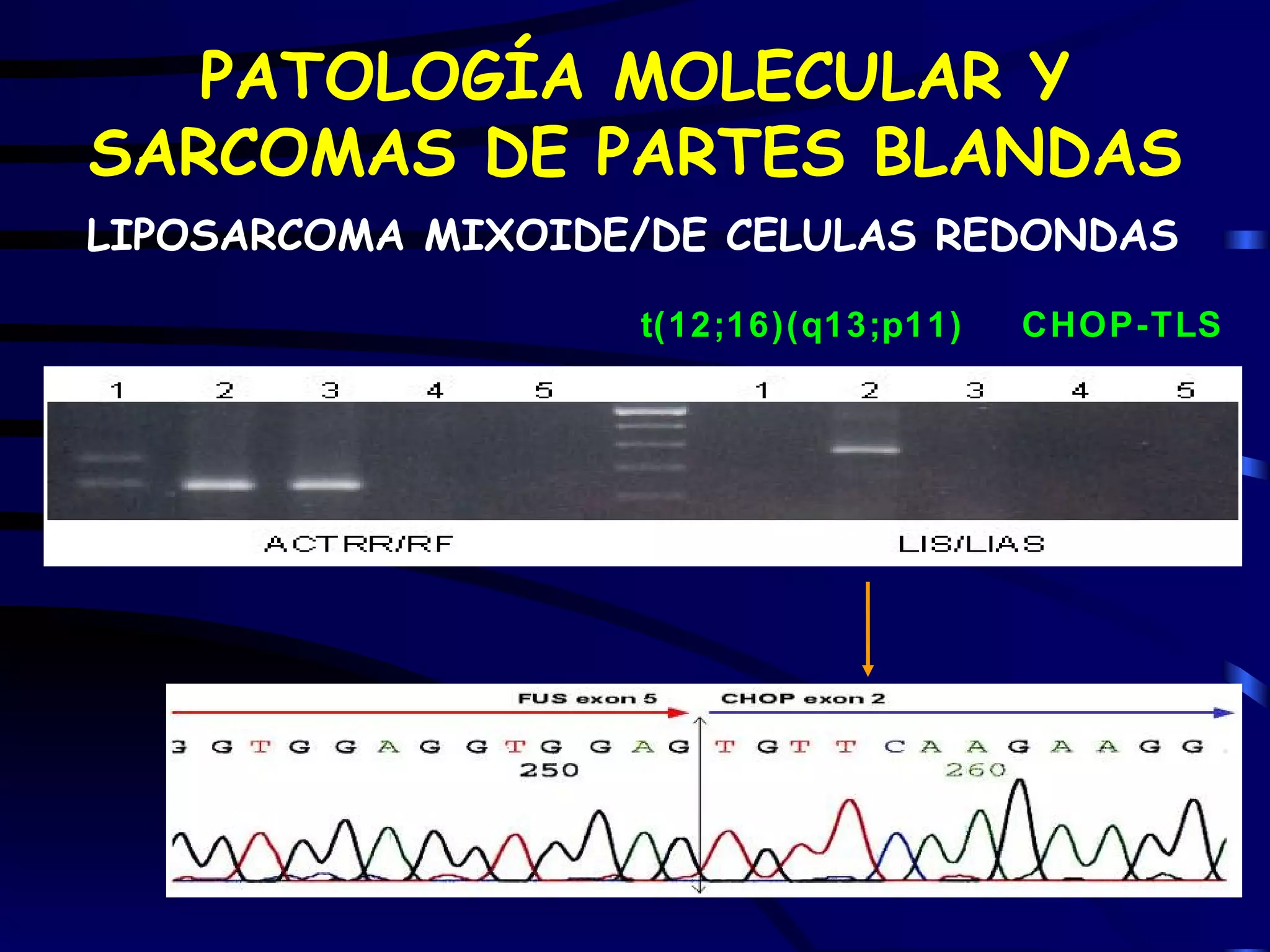 DiagnóStico Molecular De Los Sarcomas De Partes Blandas | PPT