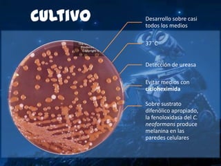Cryptococcus neoformans | PPT