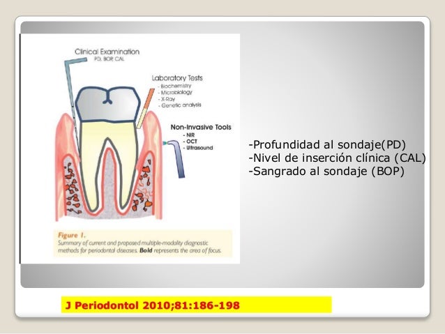 Diagnóstico en periodoncia