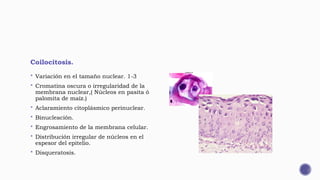 Diagnóstico histológico de las lesiones preneoplásicas cervicales.pptx