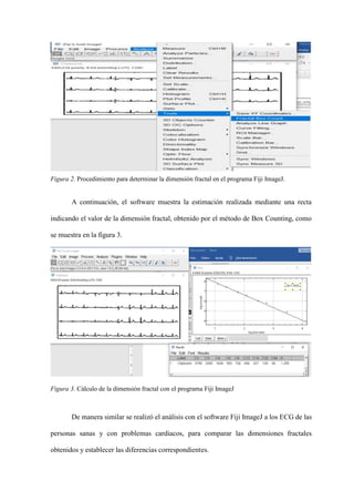 DIAGNÓSTICO DE ENFERMEDADES CARDÍACAS MEDIANTE LA DIMENSIÓN FRACTAL.pdf
