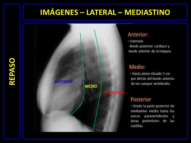 Diagnóstico por imágenes radiografía de tórax normal