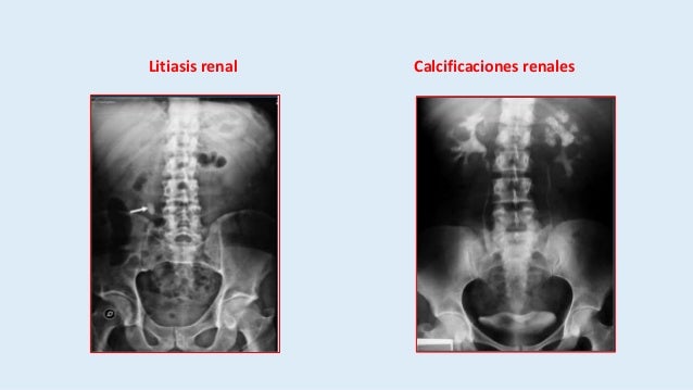 Diagnóstico por imágenes en nefrología
