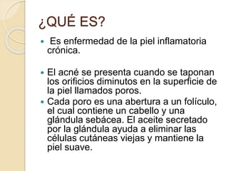 Diagnóstico y tratamiento del acné | PPTX