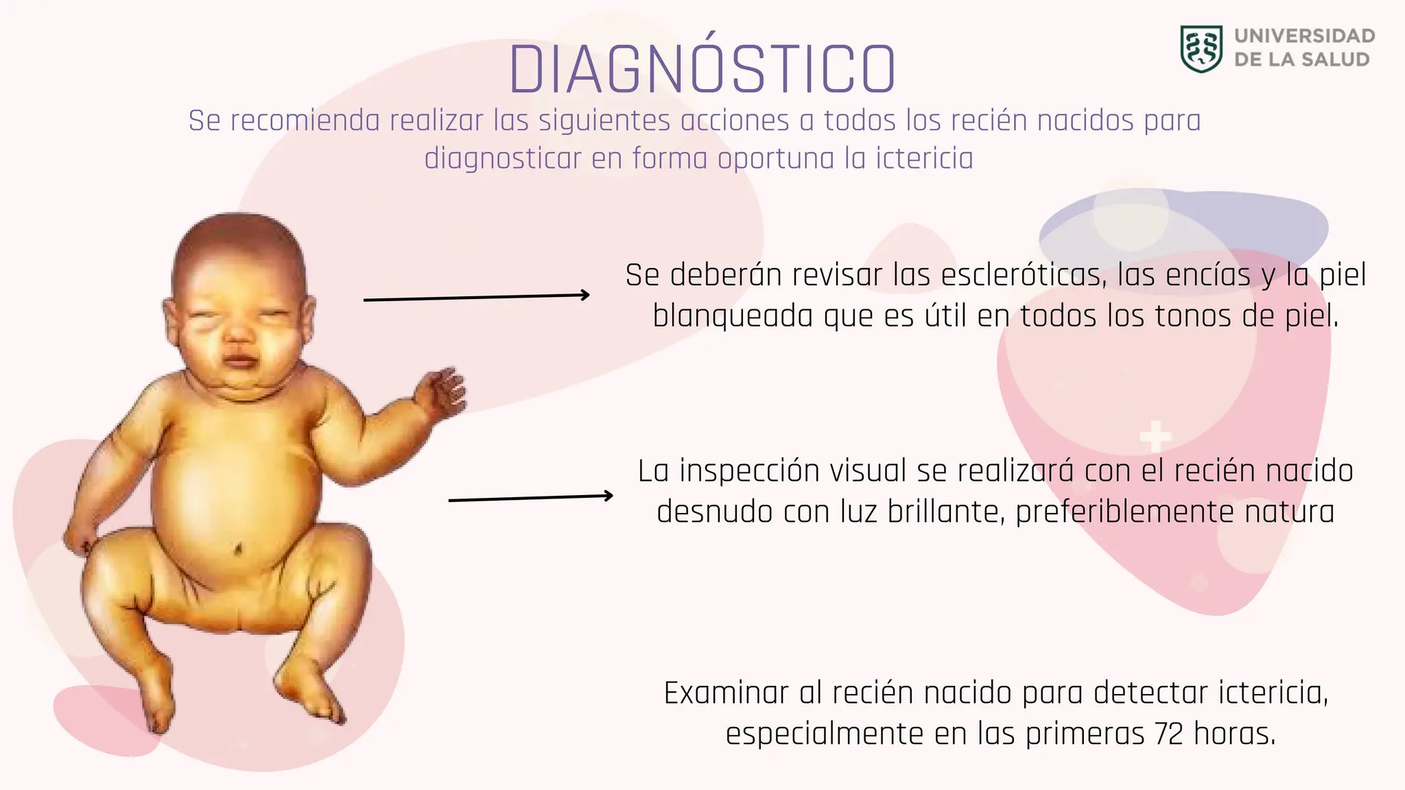 Diagnóstico y tratamiento de la ictericia neonatal.pdf