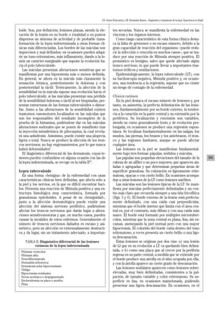 Diagnóstico y Tratamiento de Lepra. Experiencia en Brasil | PDF