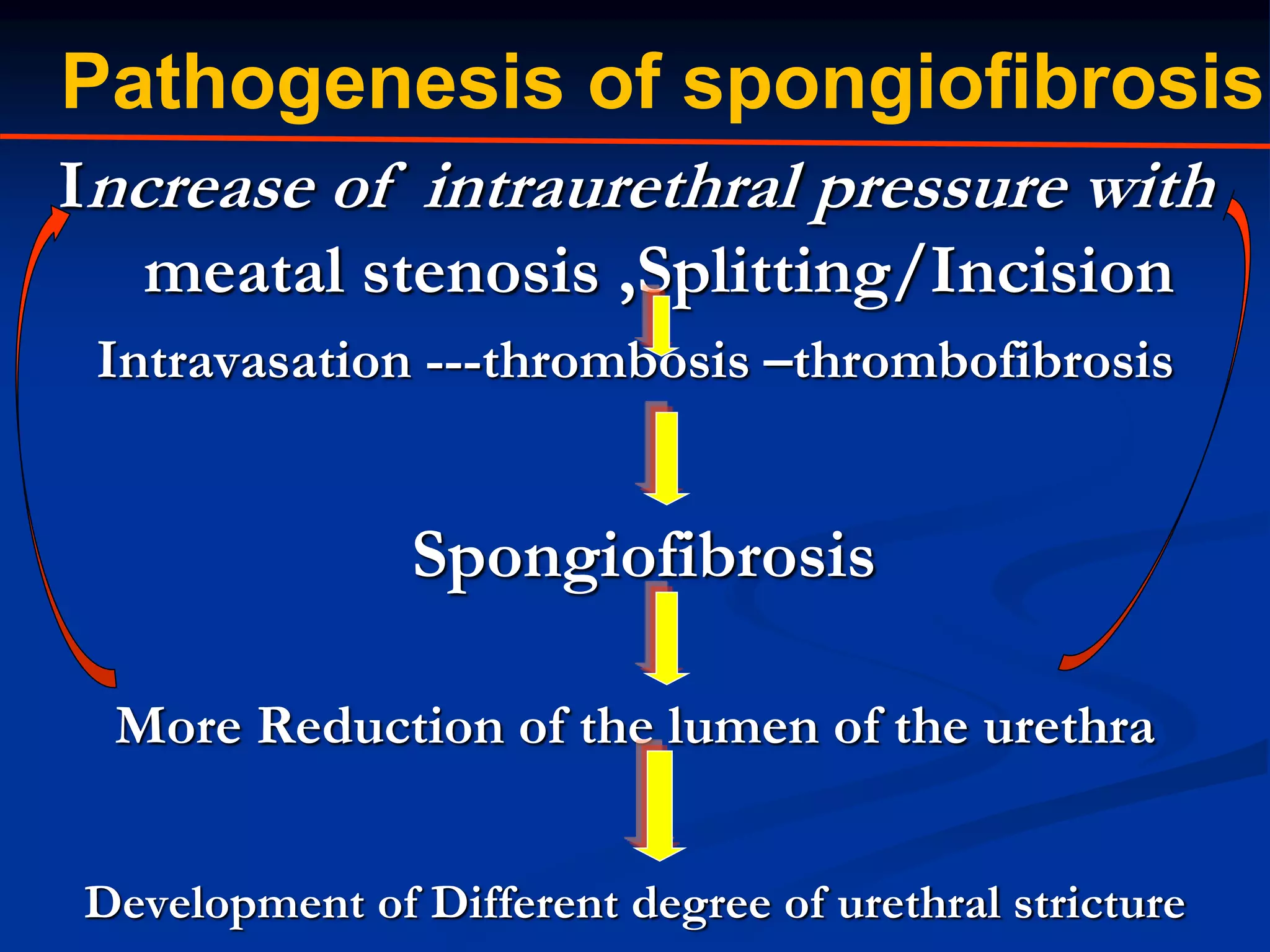 Diagosis of urethral stricture | PPTX