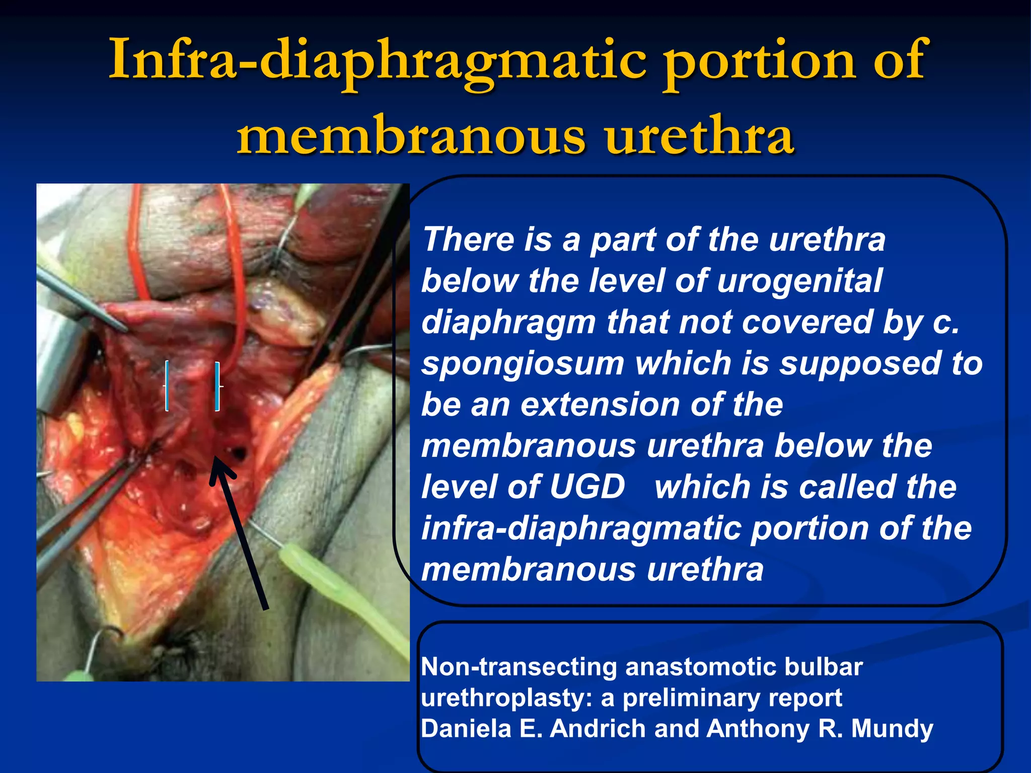 Diagosis of urethral stricture | PPTX