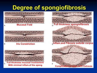 Diagosis of urethral stricture | PPTX