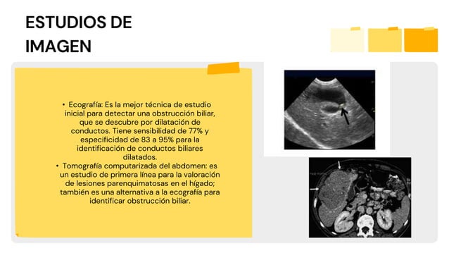 Diagrama De Afinidad Lluvia De Ideas Presentaciónpptx