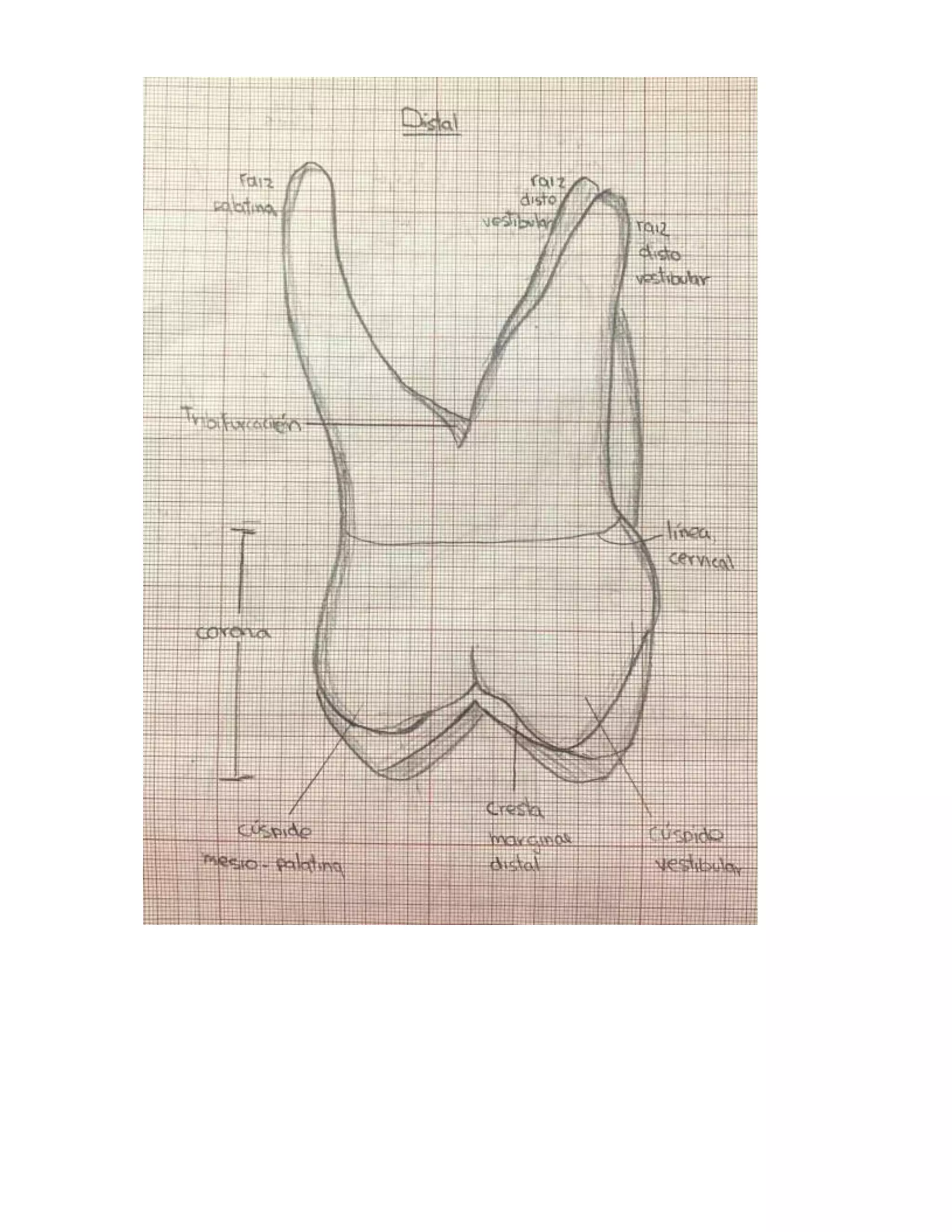 DIAGRAMA SEGUNDO MOLAR SUPERIOR.docx