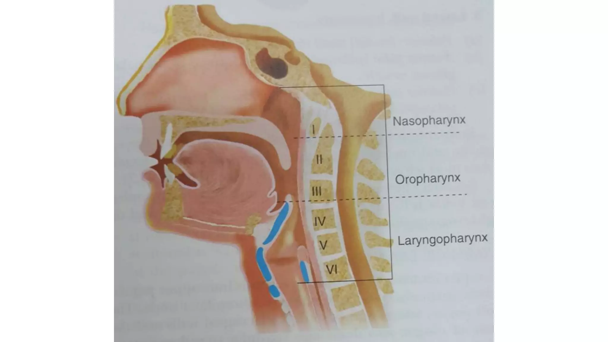 Diagrammatic representation of ca nasopharynx | PPT