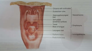 Diagrammatic representation of ca nasopharynx | PPTX