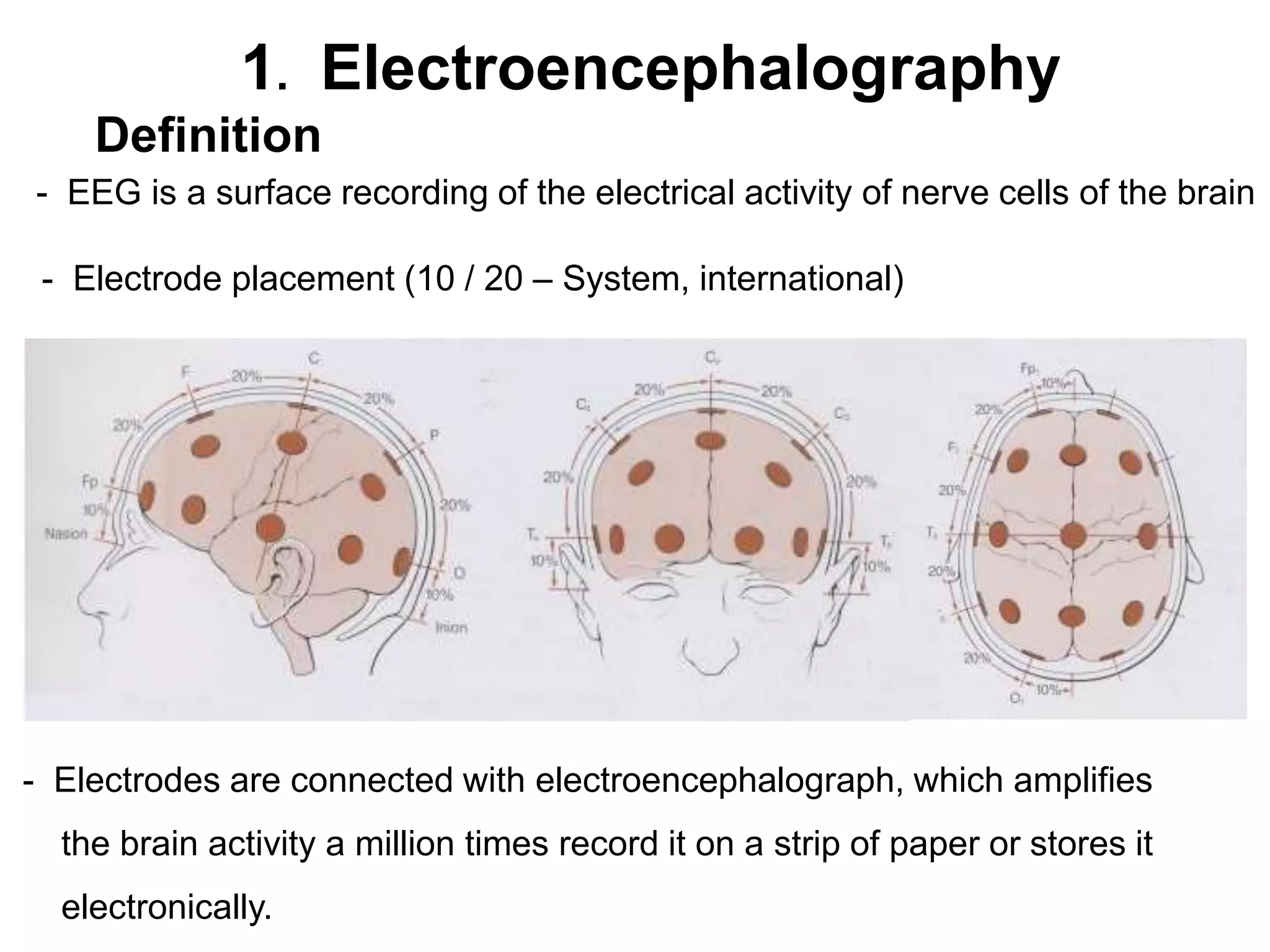 Diagrams-Eeg-Epilepsy.ppt
