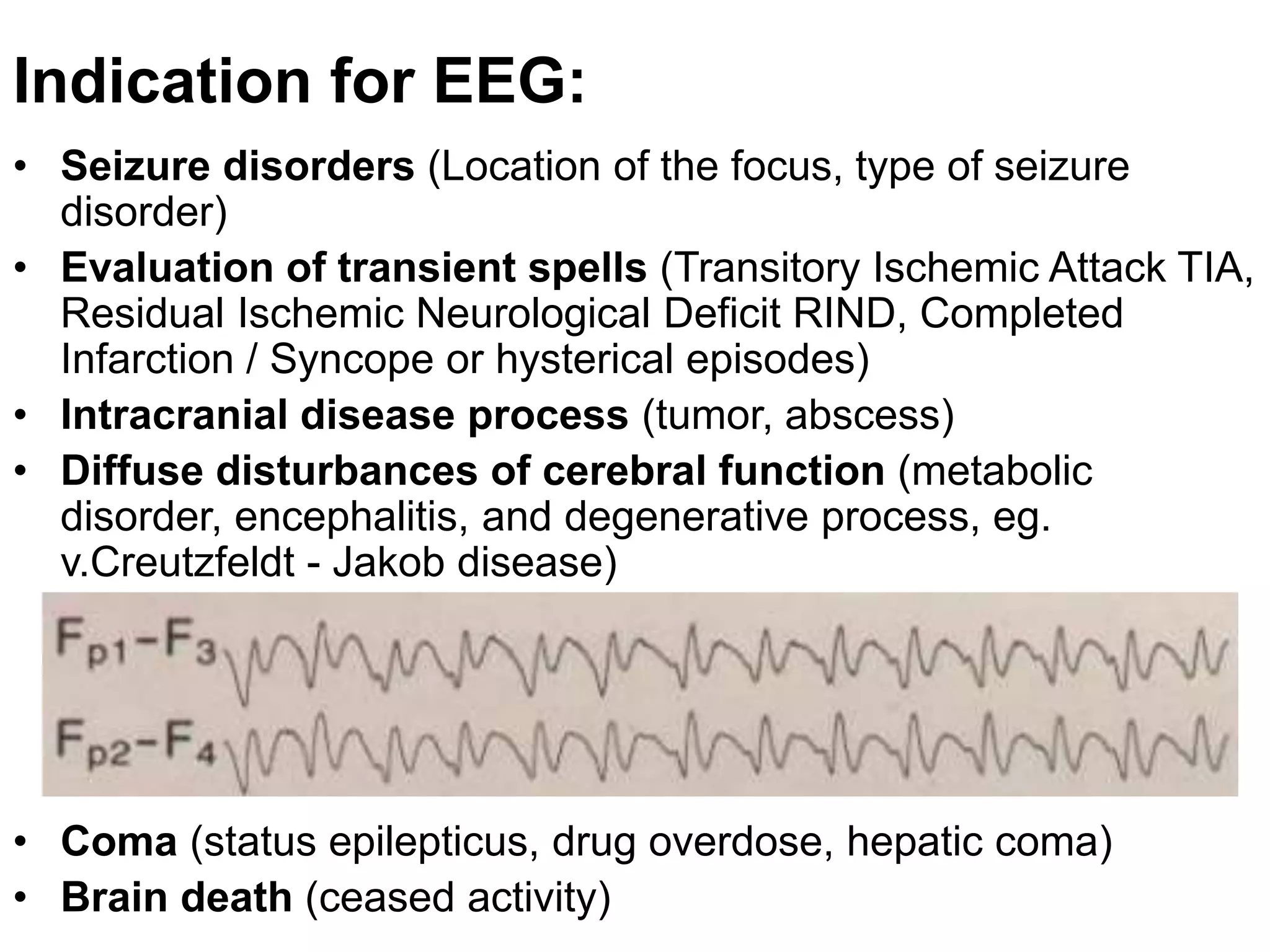 Diagrams-Eeg-Epilepsy.ppt
