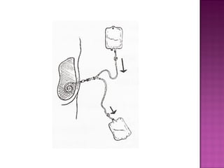 Dialisis peritoneal | PPT